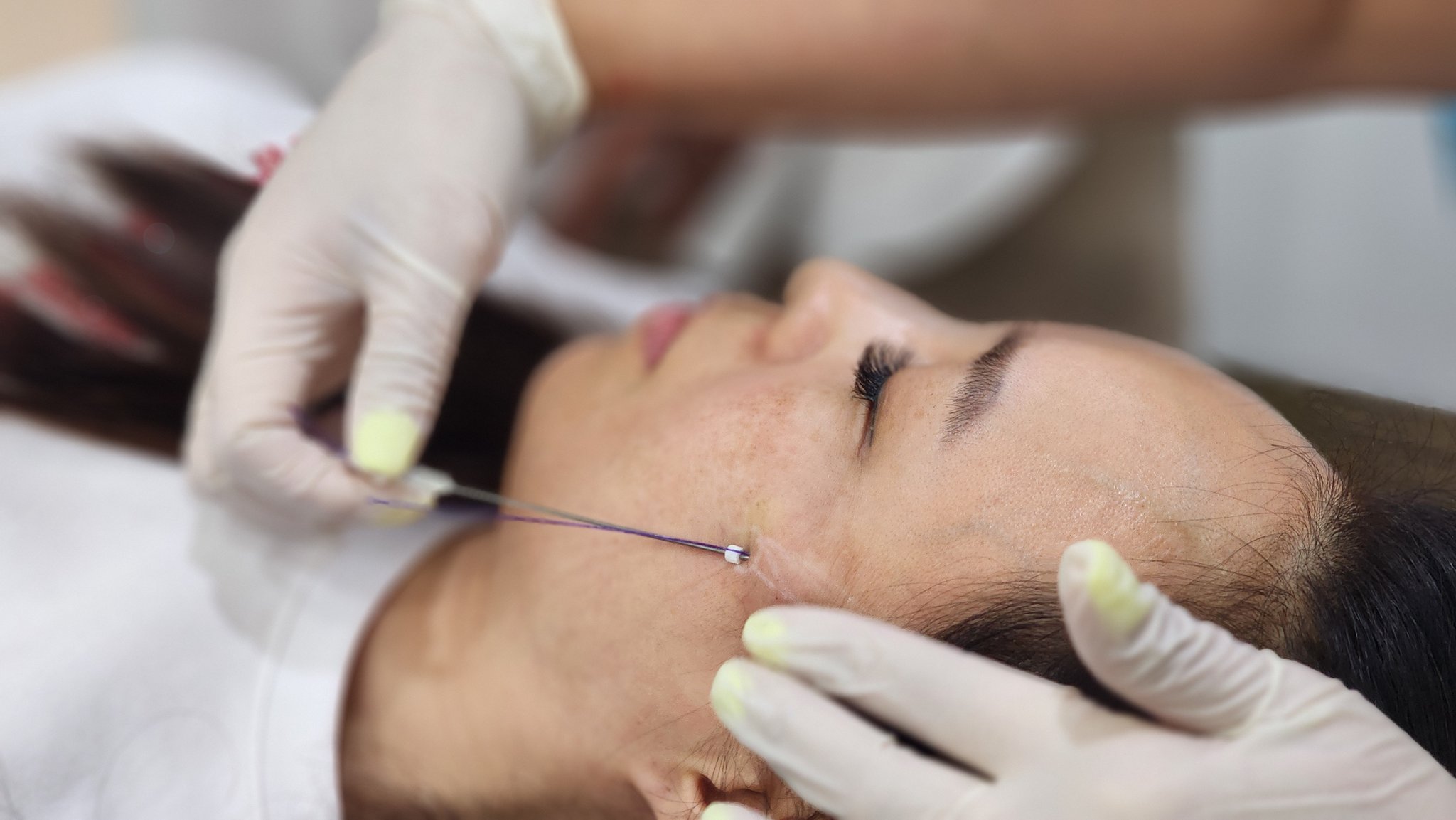 4 DAYS INJECTABLES (FACE) - AMOAESTHETICS ACADEMY